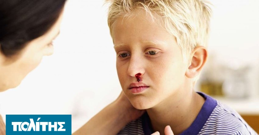 Ρινορραγία στα παιδιά. Τι κάνω όταν «ανοίξει η μύτη»; | politischios.gr