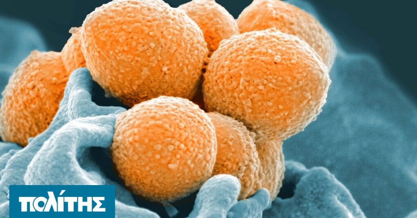 ΕΟΔΥ: Ο πρώτος θάνατος από στρεπτόκοκκο Α στη χώρα | politischios.gr